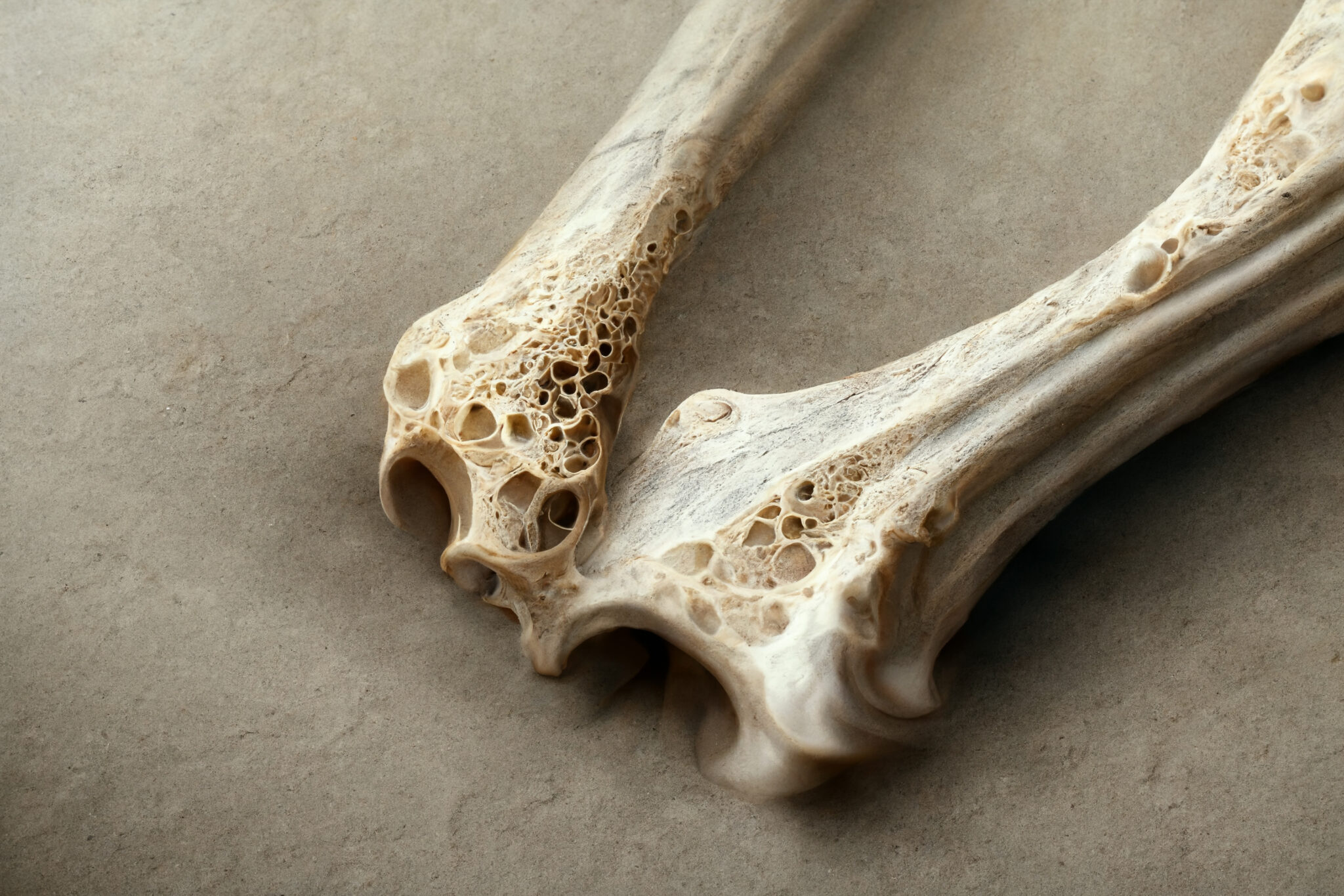 Why is Calcium Essential for Bone Health? The Best Type, AdvaCAL ...